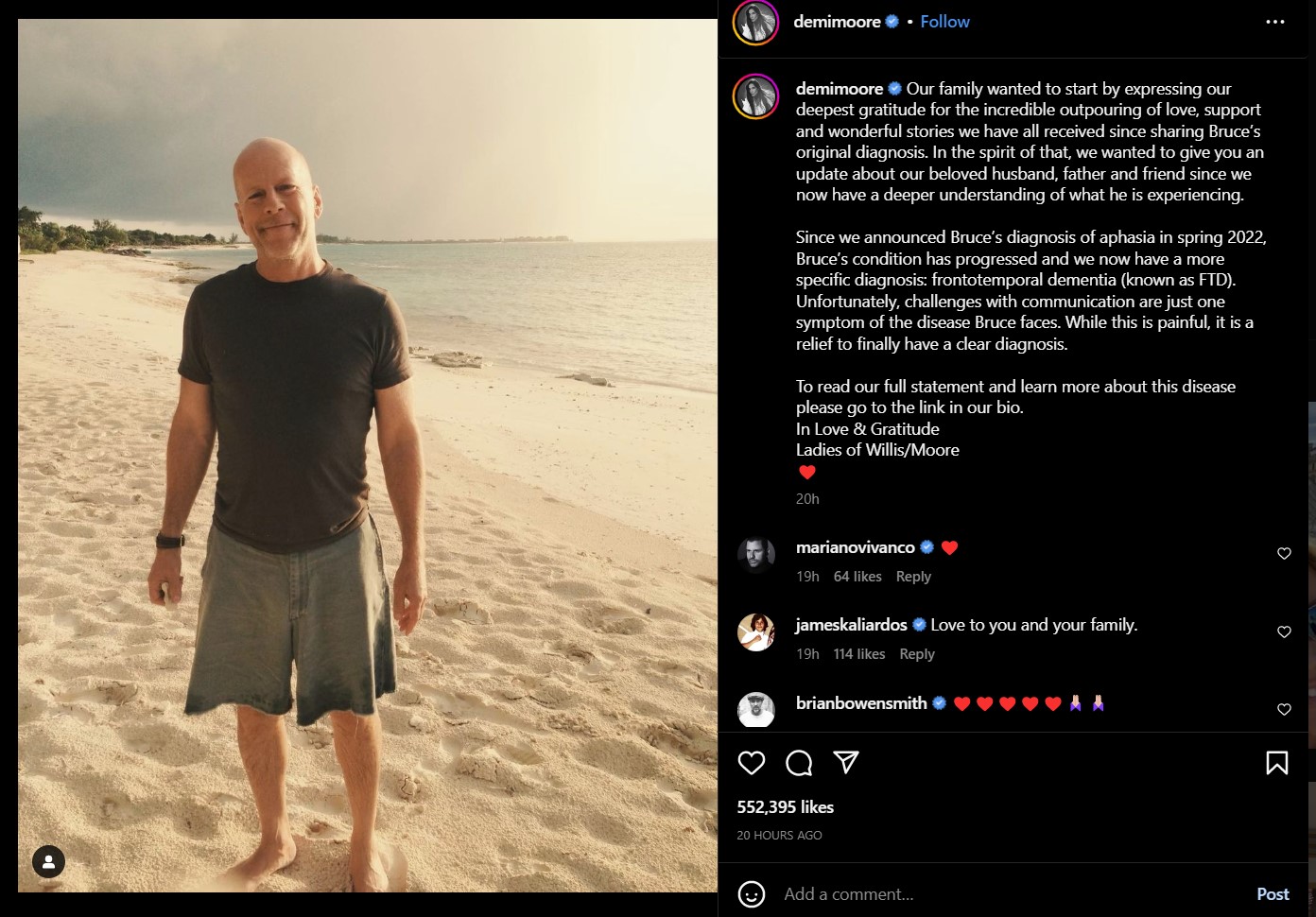 Bruce Willis condition update, now diagnosed with ‘frontotemporal ...